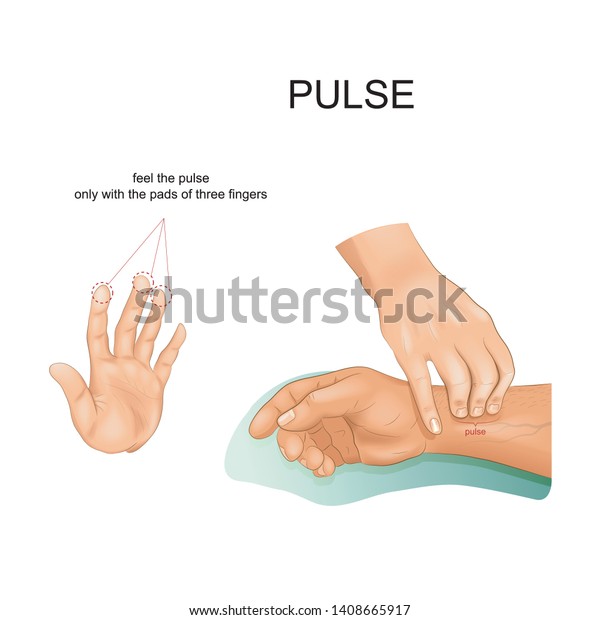 Vector Illustration Correct Pulse Palpation: vector de stock (libre de ...
