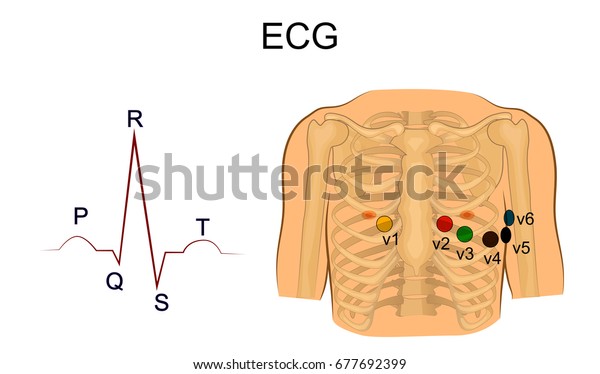 1,876 Chest Ekg Images, Stock Photos & Vectors | Shutterstock