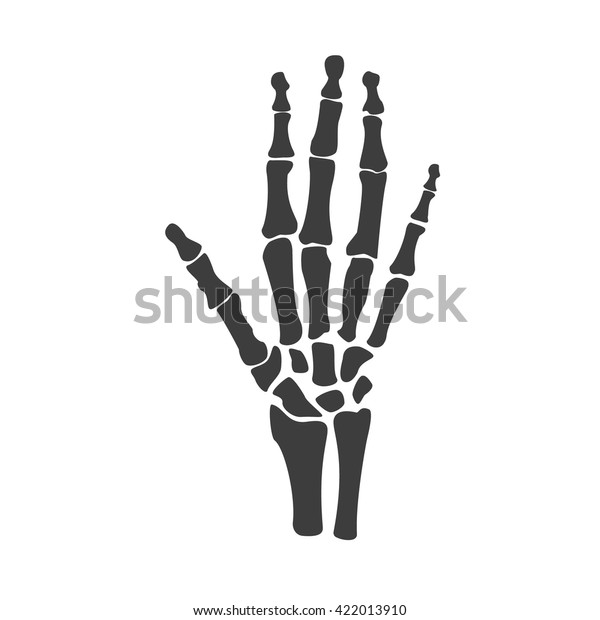 Vector Illustration Hand Bones Orthopedic Human Stock Vector (Royalty ...