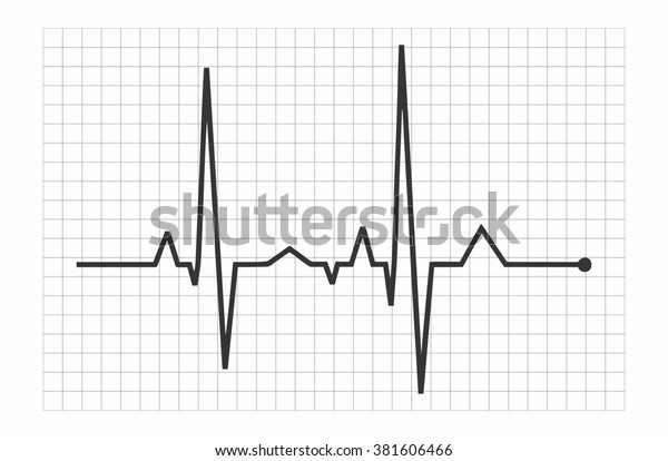 Vector Illustration Heart Rhythm Ekg Stock Vector (Royalty Free) 381606466