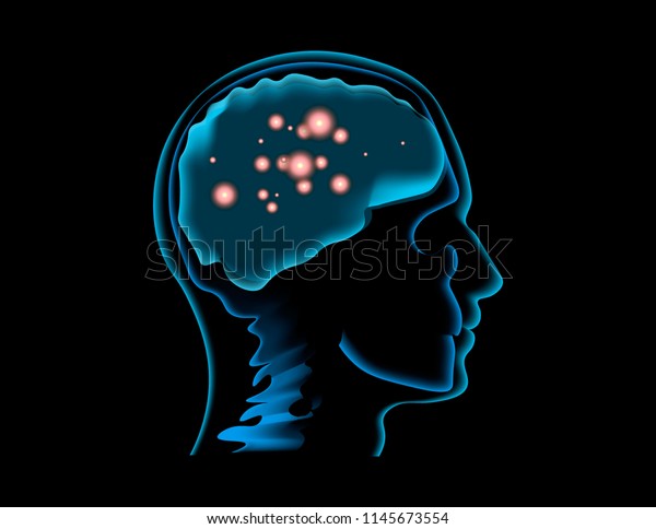 Vector Illustration Human Brain Scan During: immagine vettoriale stock ...
