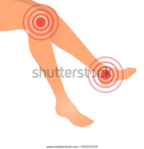 Vector illustration of leg joints pain, medical supplement or medicine ...