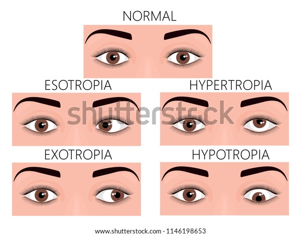 Vector Illustration Normal Human Eyes Eyes Stock Vector (Royalty Free ...