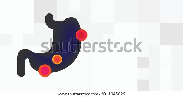 Vector Illustration Stomach Red Spots Digestive Stock Vector (Royalty ...