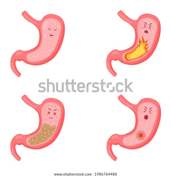 Vector Medical Illustration Stomach Inside Healthy: เวกเตอร์สต็อก (ปลอด ...