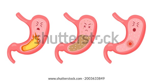 Vector Medical Illustration Stomach Inside Healthy Stock Vector ...