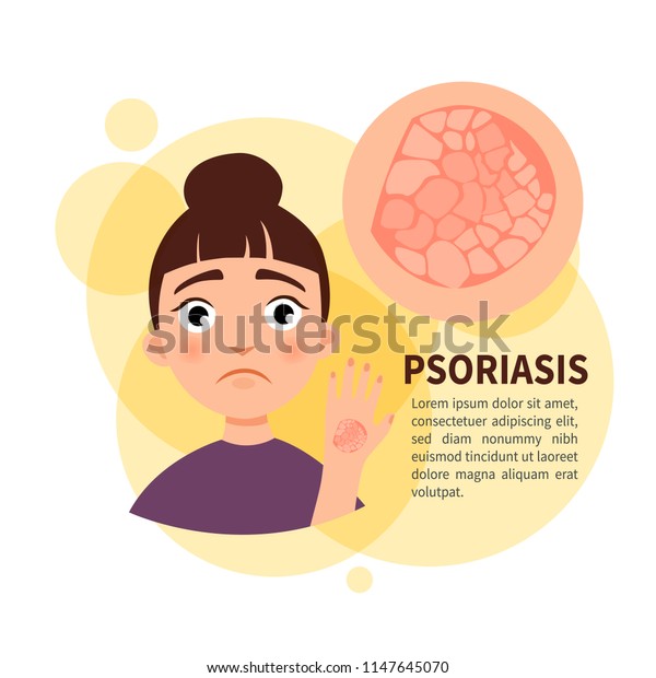 Vector Poster Psoriasis Sad Cute Girl Stock Vector Royalty Free