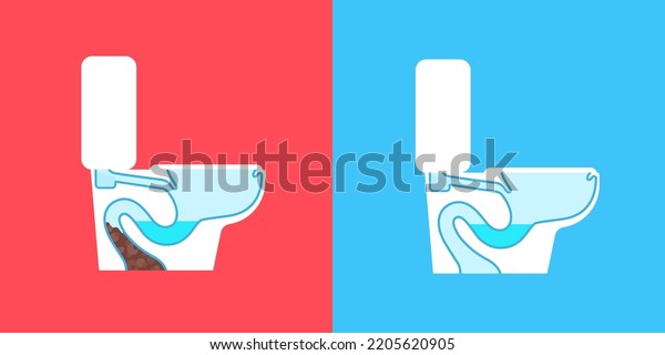 Vector Toilet Detergent Illustration Garbage Stuck Stock Vector ...