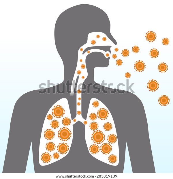 Virus Infection Image Illustration Stock Vector (Royalty Free ...
