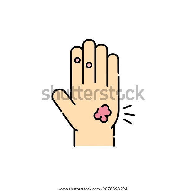 Warts Color Line Icon Human Diseases Stock Vector (Royalty Free ...