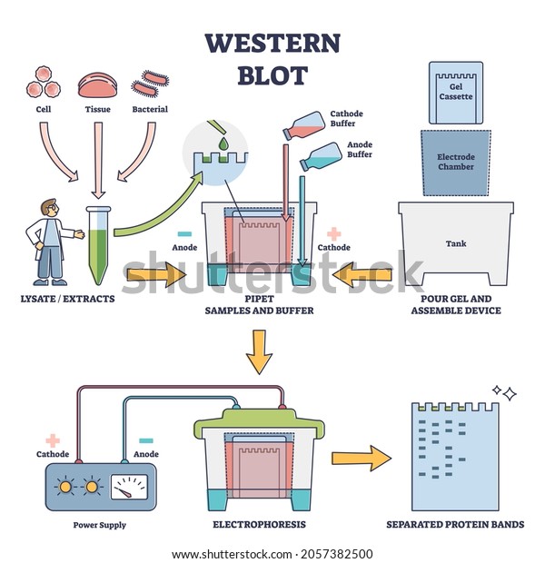 Western Blot Laboratory Method Detecting Specific Stock Vector (Royalty ...