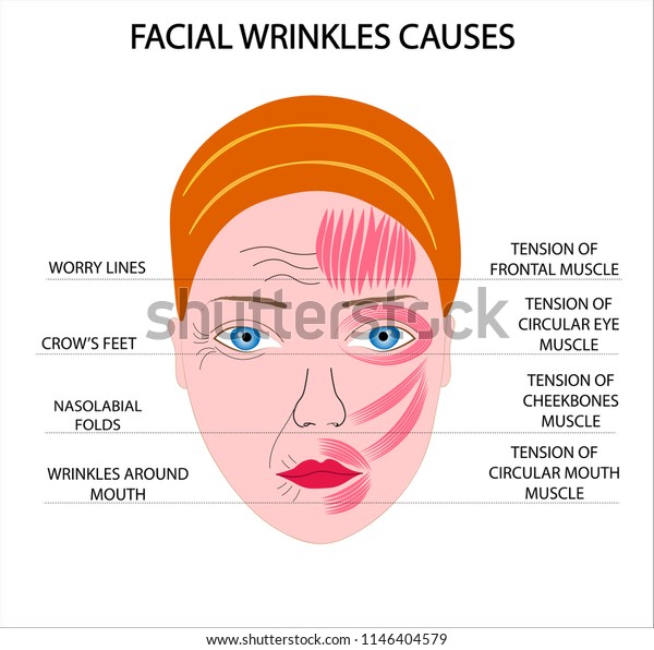 Woman Face Scheme Demonstrating Causes Facial Stock Vector (Royalty ...