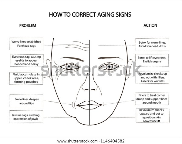 Woman Face Scheme Demonstrating Causes Facial 库存矢量图（免版税）1146404582