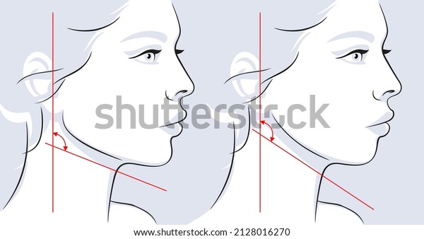 47 Lower Jaw Angles Images, Stock Photos & Vectors | Shutterstock
