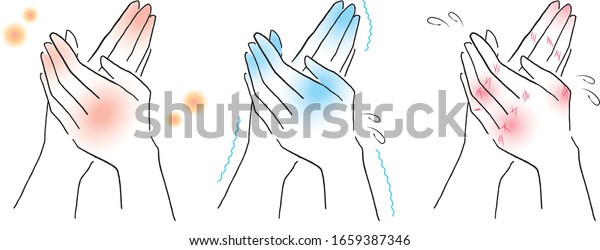 Womans Poor Circulation Hands Due Cold Stock Vector (Royalty Free ...