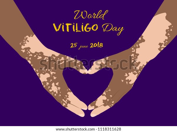 World Vitiligo Day Poster Stock Vector (Royalty Free) 1118311628 ...