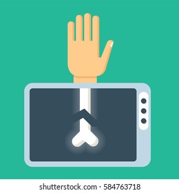 Xray Human Hand Vector Illustration Stock Vector (Royalty Free ...