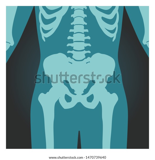 Xray Shot Pelvis Spinal Column Human Stock Vector (Royalty Free ...