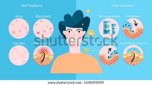 Young Man Bad Skin Problems Ant Stock Vector (Royalty Free) 1640498989 ...