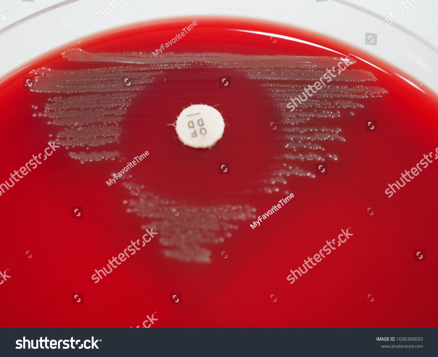 Positive Result Optochin Susceptibility Testing Streptococcus Stock