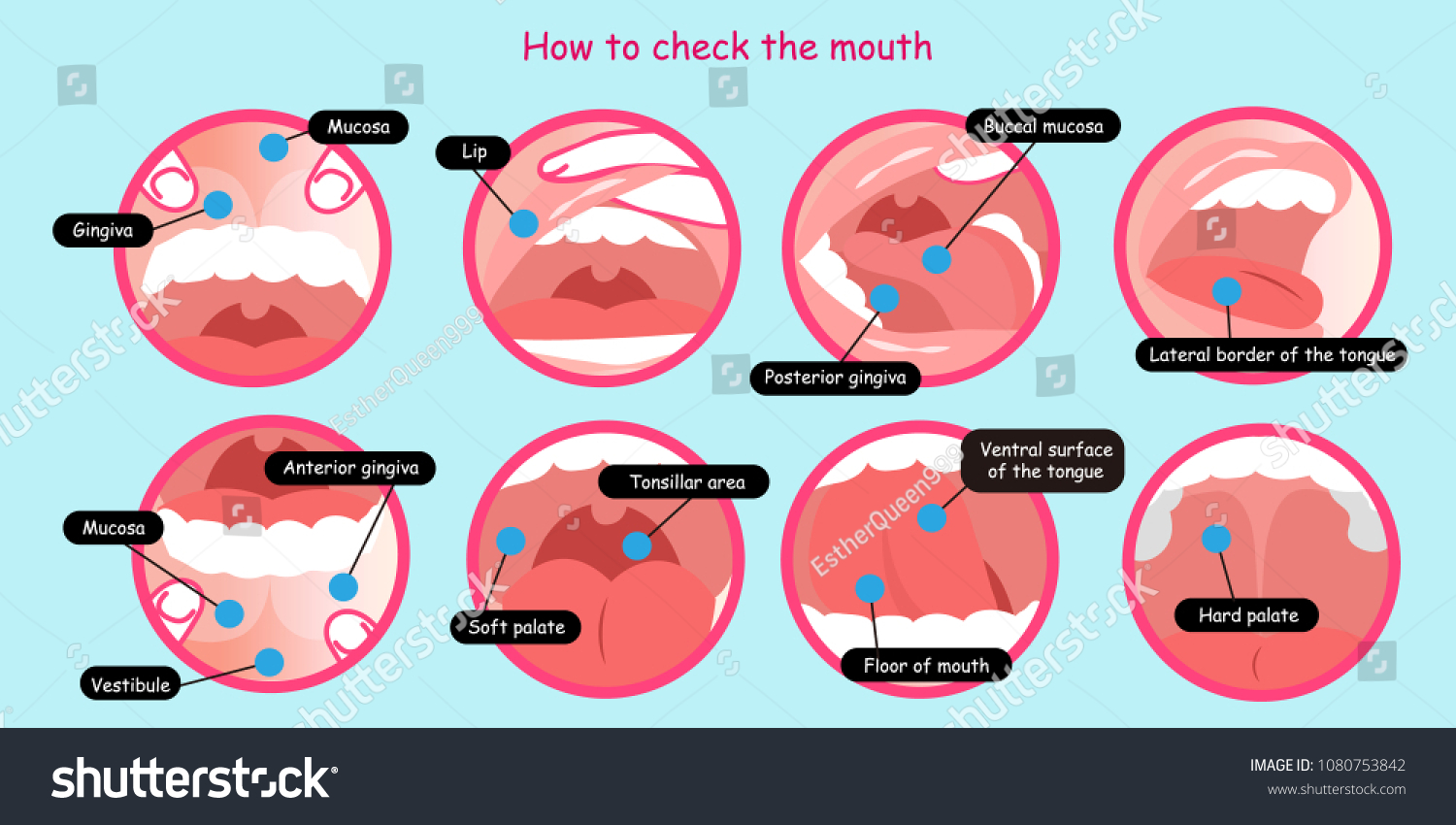 25 Imágenes De Buccal Mucosa Cancer Imágenes Fotos Y Vectores De Stock Shutterstock