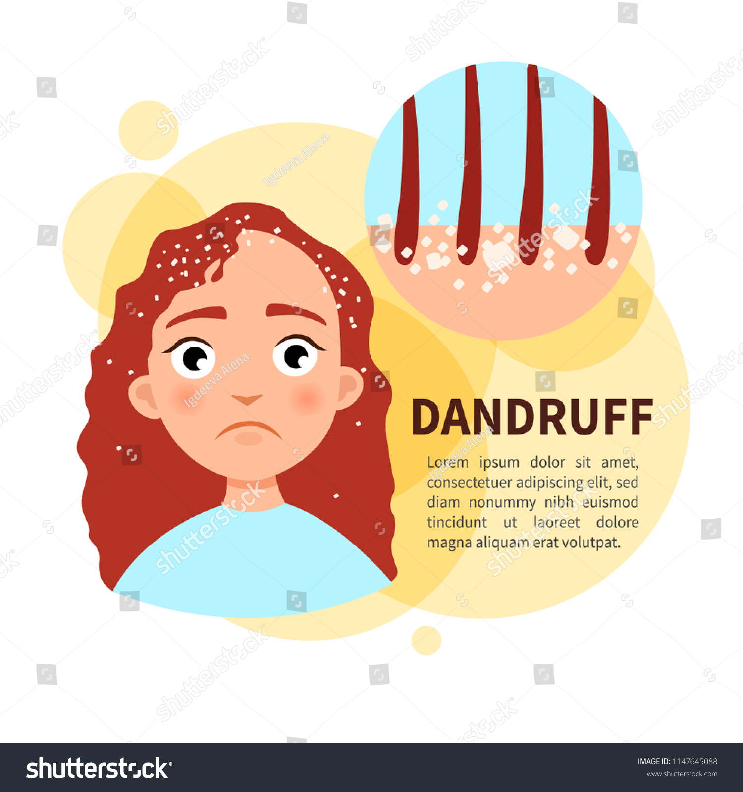 55 Facial Dandruff Illustration Images, Stock Photos & Vectors ... 55 Facial Dandruff Illustration Images, Stock Photos & Vectors ...