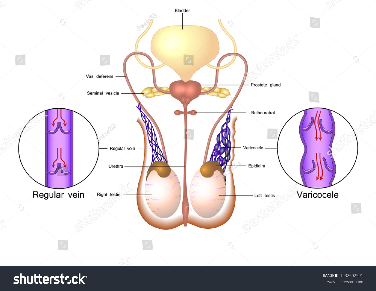 Varicocele Male Reproductive System Stock Vector Royalty Free 1232602591 Shutterstock