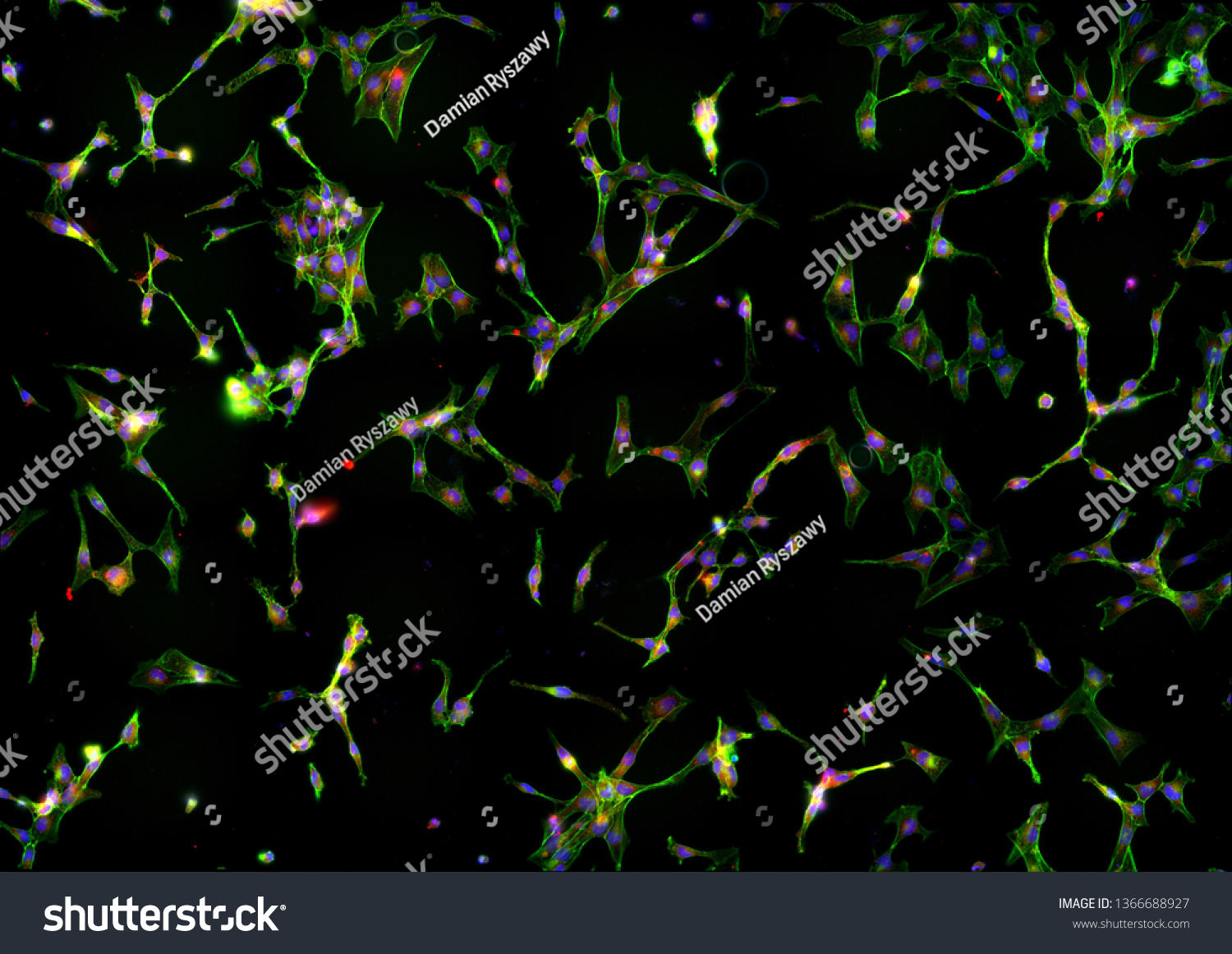 Real Fluorescence Microscopic View Human Skin库存照片1366688927 Shutterstock