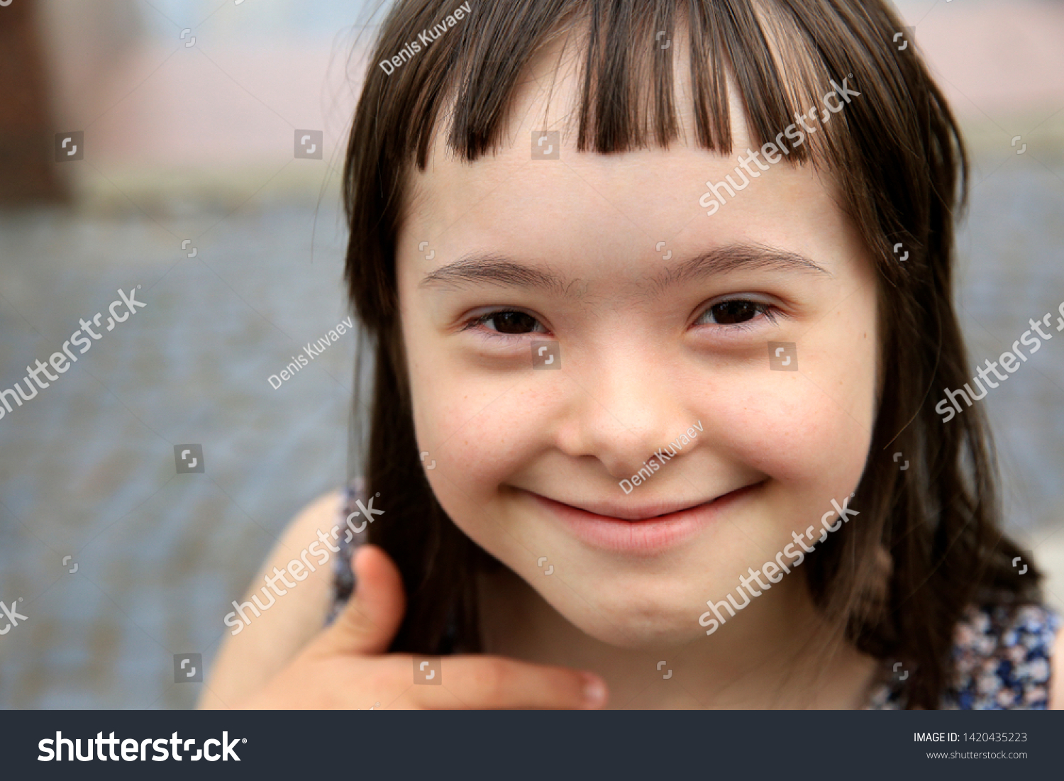 Cute Smiling Down Syndrome Girl On Foto Stok 1420435223 Shutterstock