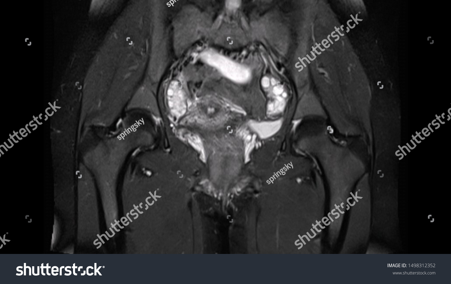 214 Pelvic Mri 이미지 스톡 사진 및 벡터 Shutterstock