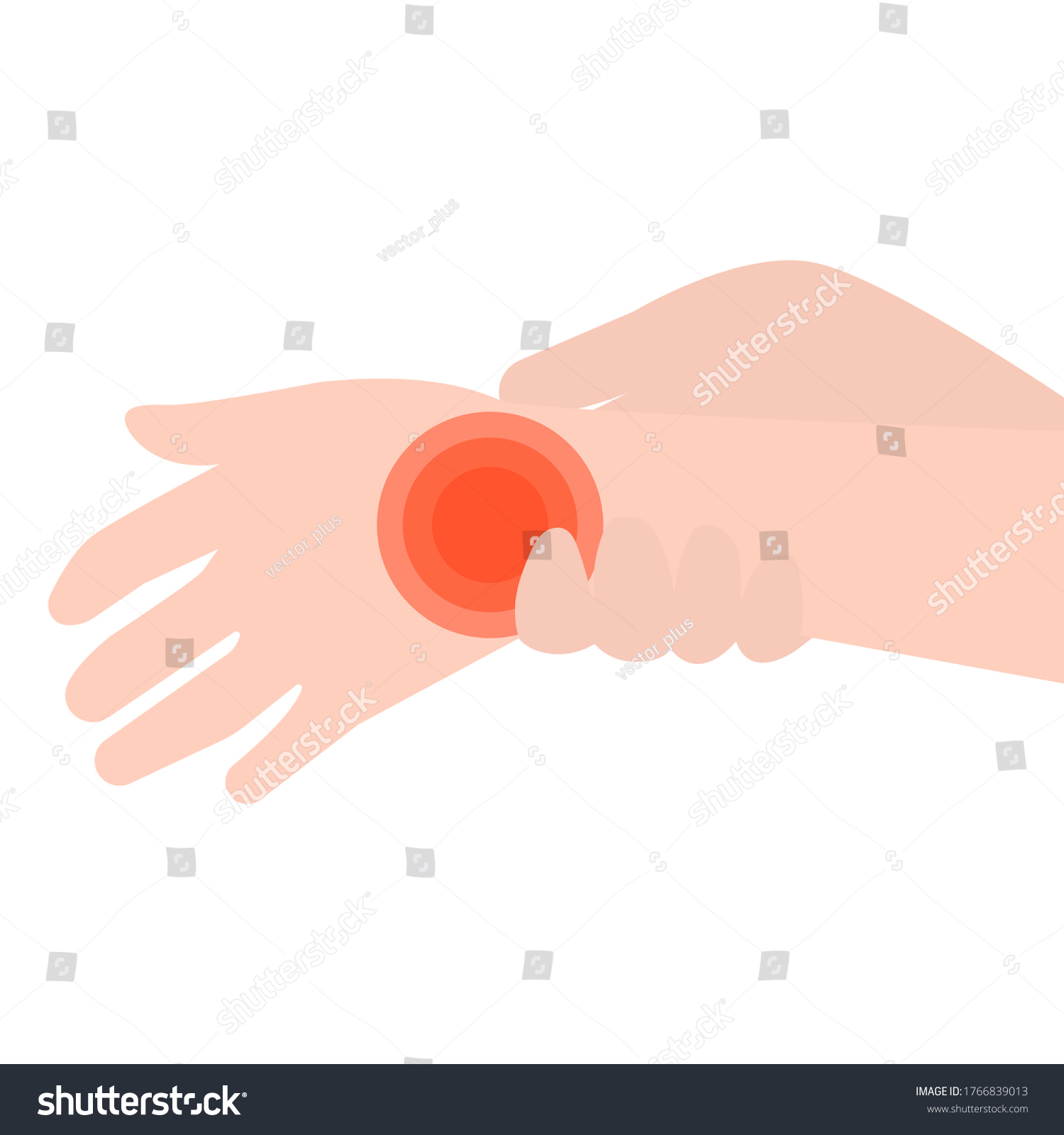 Burn On Arm Vector Image Eps เวกเตอร์สต็อก ปลอดค่าลิขสิทธิ์