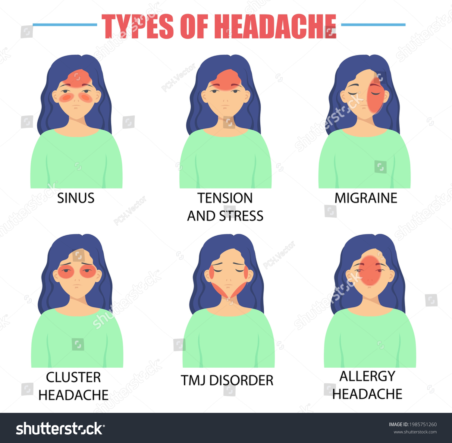 Different Types Headaches Vector Illustrations Set Stock Vector ... Different Types Headaches Vector Illustrations Set Stock Vector ...