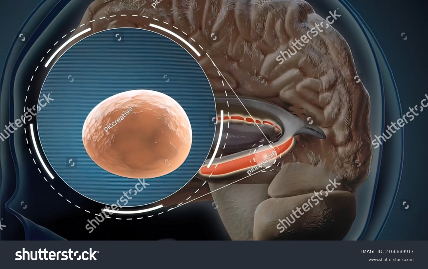 Hippocampus Complex Brain Structure Buried Deep Stock Illustration 2166889917 Shutterstock