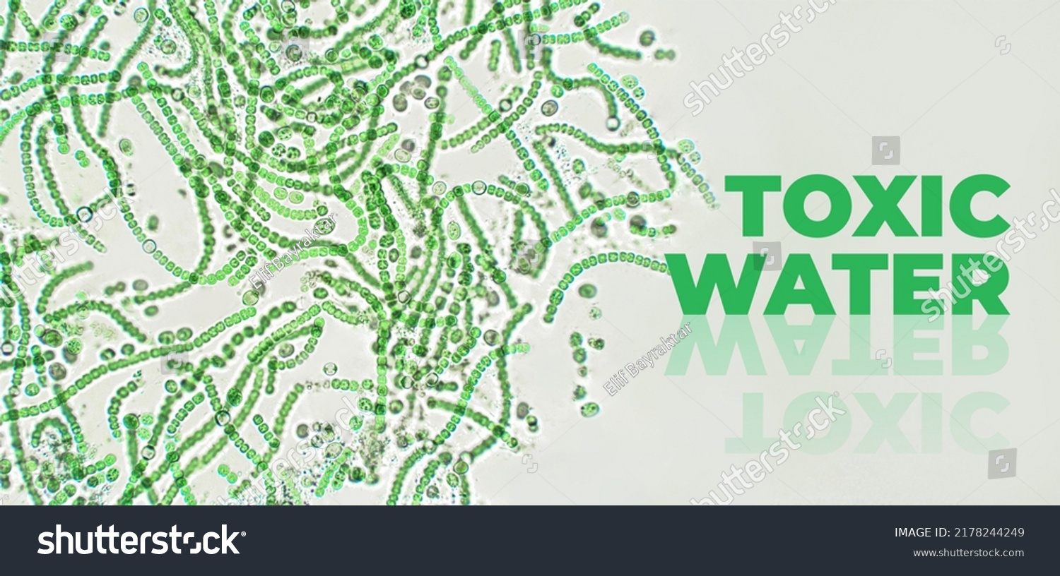 Nostoc Sp Blue Green Algae Under Stock Photo 2178244249 | Shutterstock Nostoc Sp Blue Green Algae Under Stock Photo 2178244249 | Shutterstock