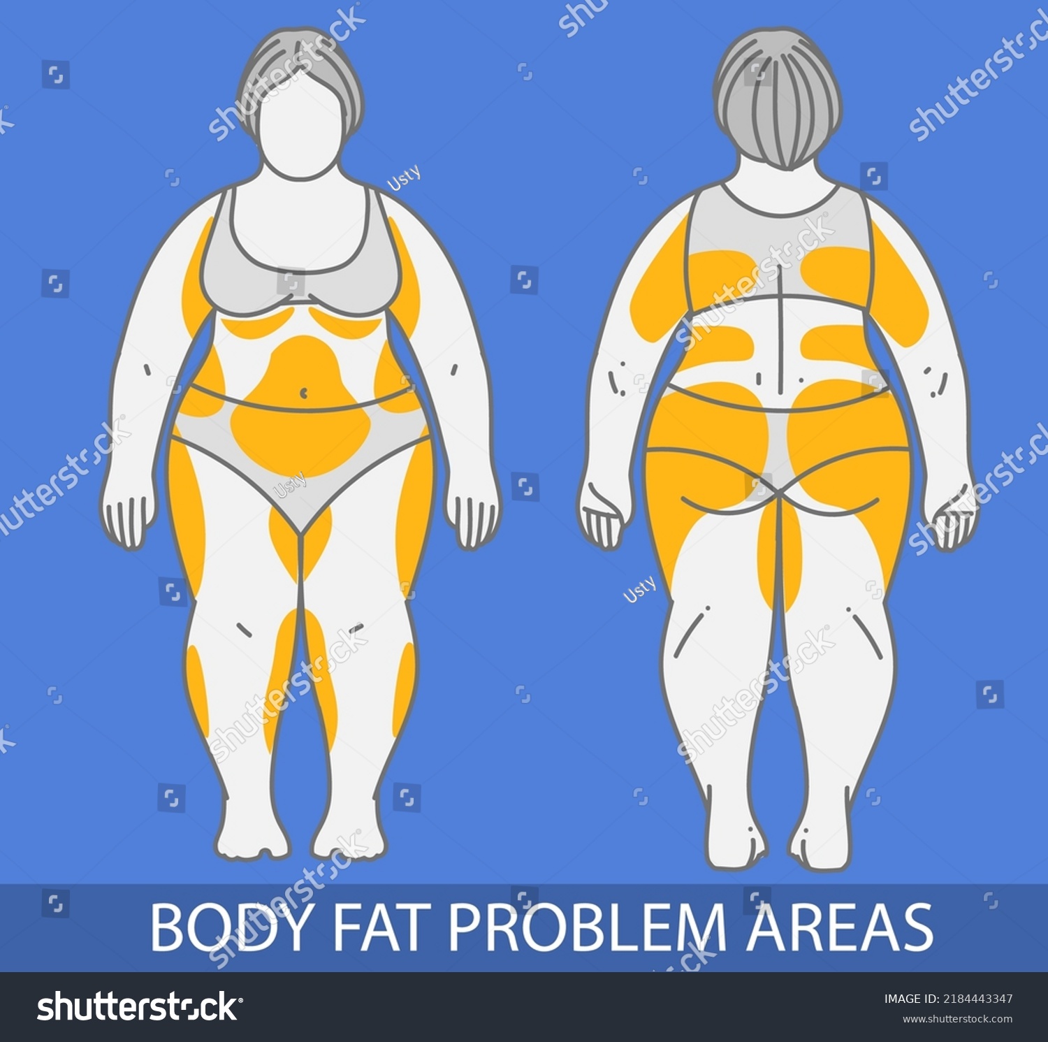 Body Fat Problem Areas Medical Infographic Stock Vector (Royalty Free ... Body Fat Problem Areas Medical Infographic Stock Vector (Royalty Free ...