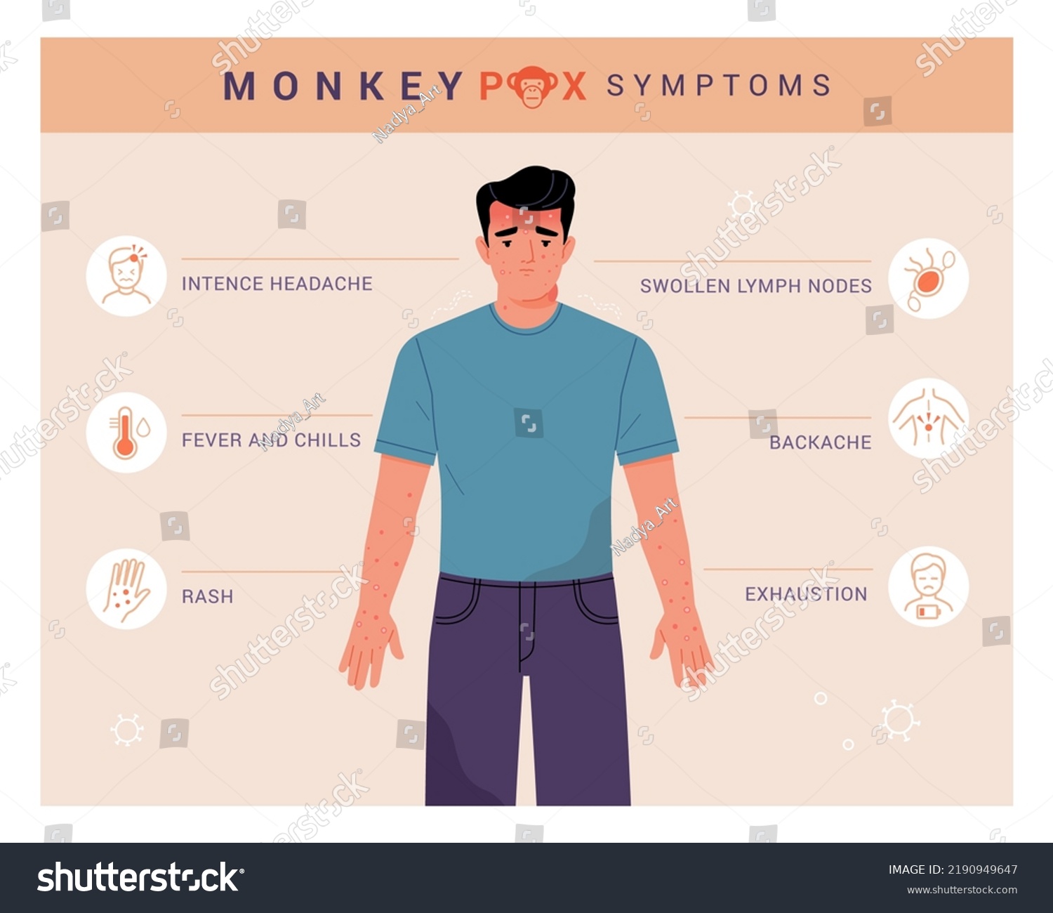 Monkeypox Virus Symptoms Vector Illustration Cartoon Stock Vector ... Monkeypox Virus Symptoms Vector Illustration Cartoon Stock Vector ...