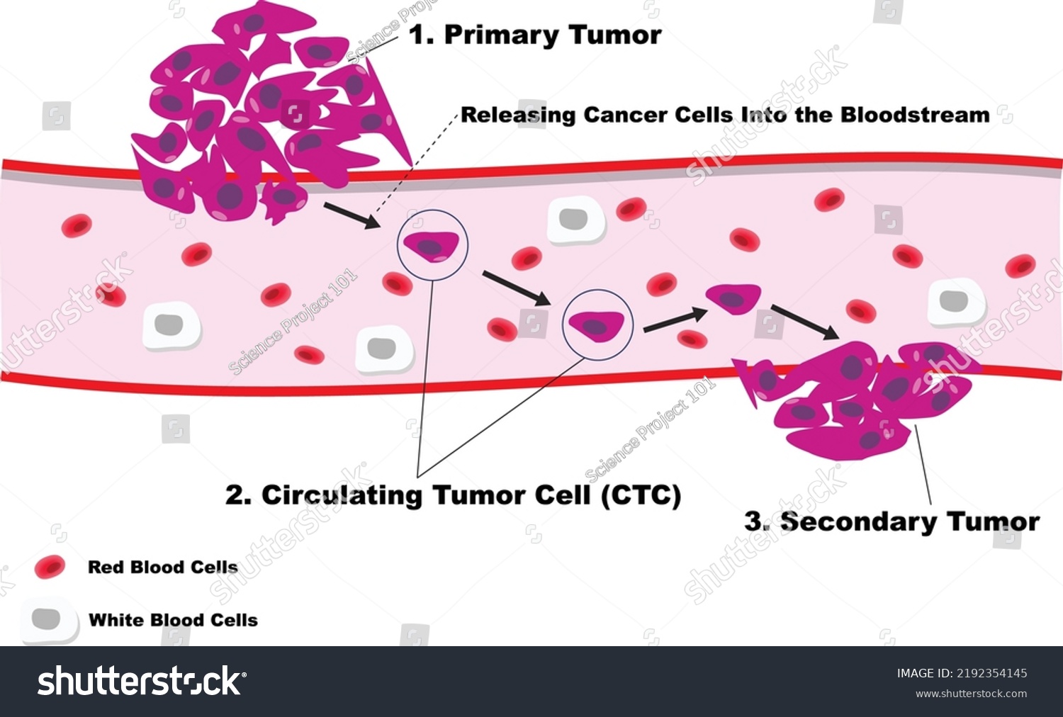 Circulating Tumor Cell Ctc Cell Cancer Stock Vector (Royalty Free ... Circulating Tumor Cell Ctc Cell Cancer Stock Vector (Royalty Free ...