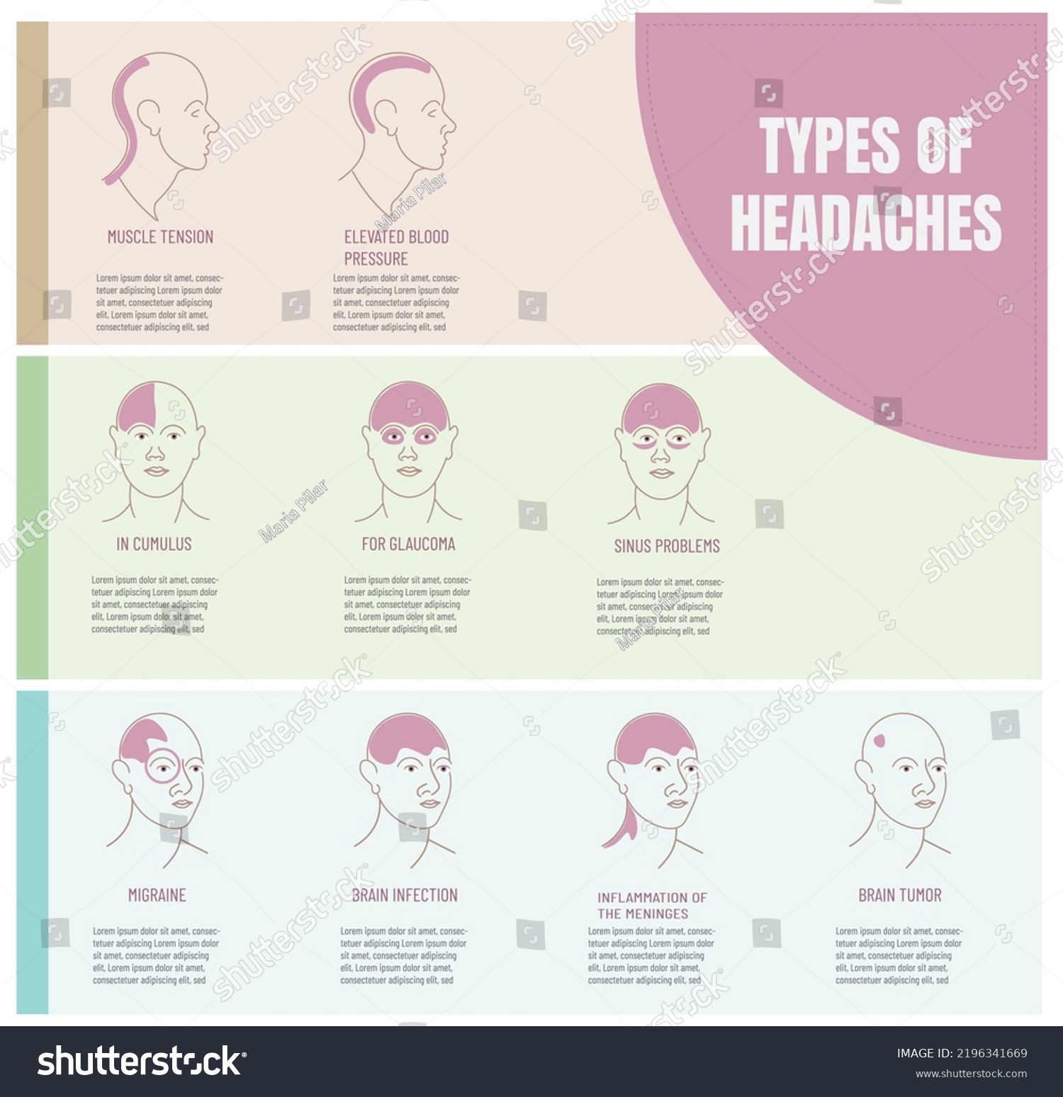 Infographic On Different Types Headaches According Stock Vector ... Infographic On Different Types Headaches According Stock Vector ...