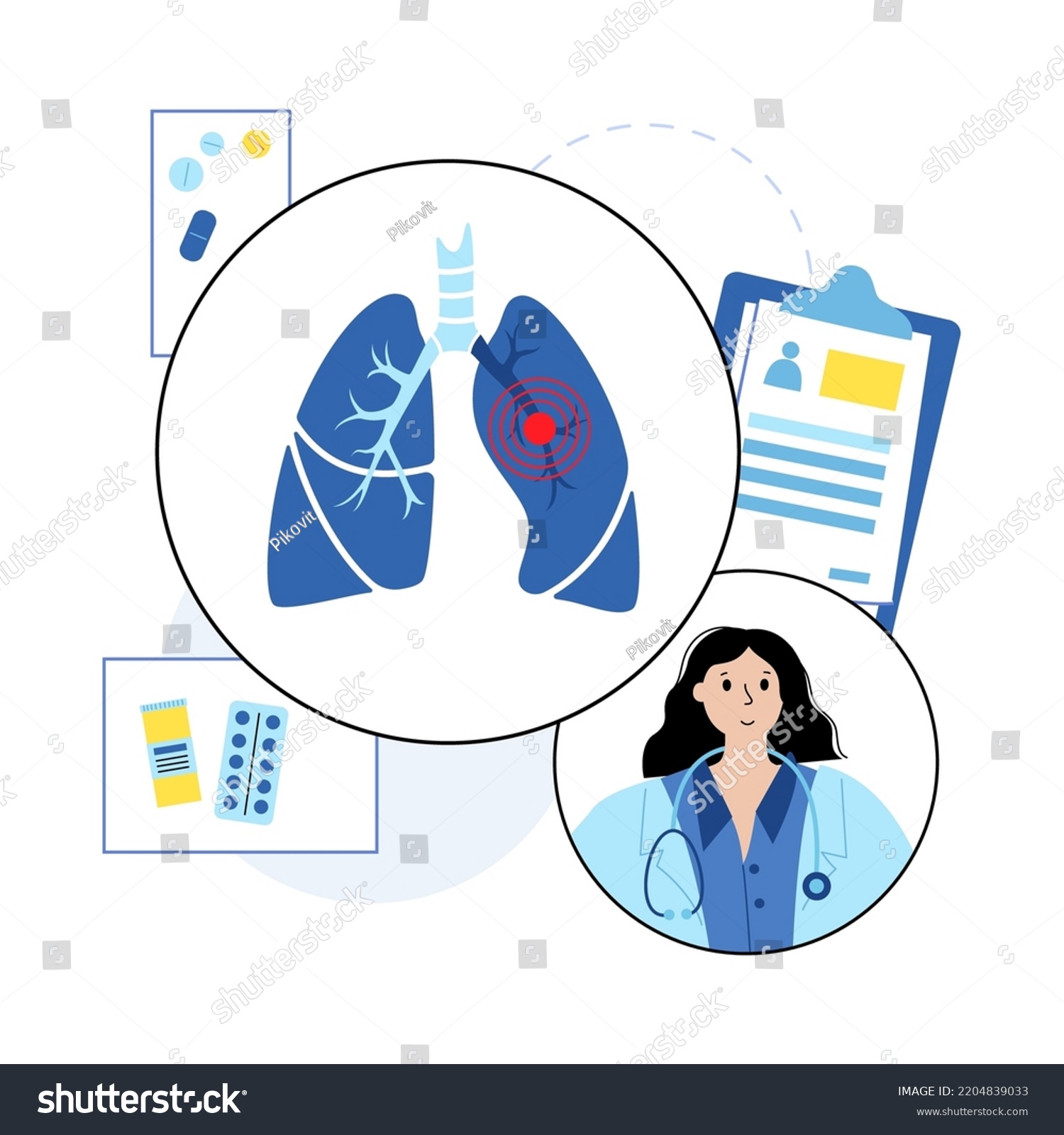 Pulmonary Embolism Disease Consultation Appointment Doctor Stock Vector Royalty Free