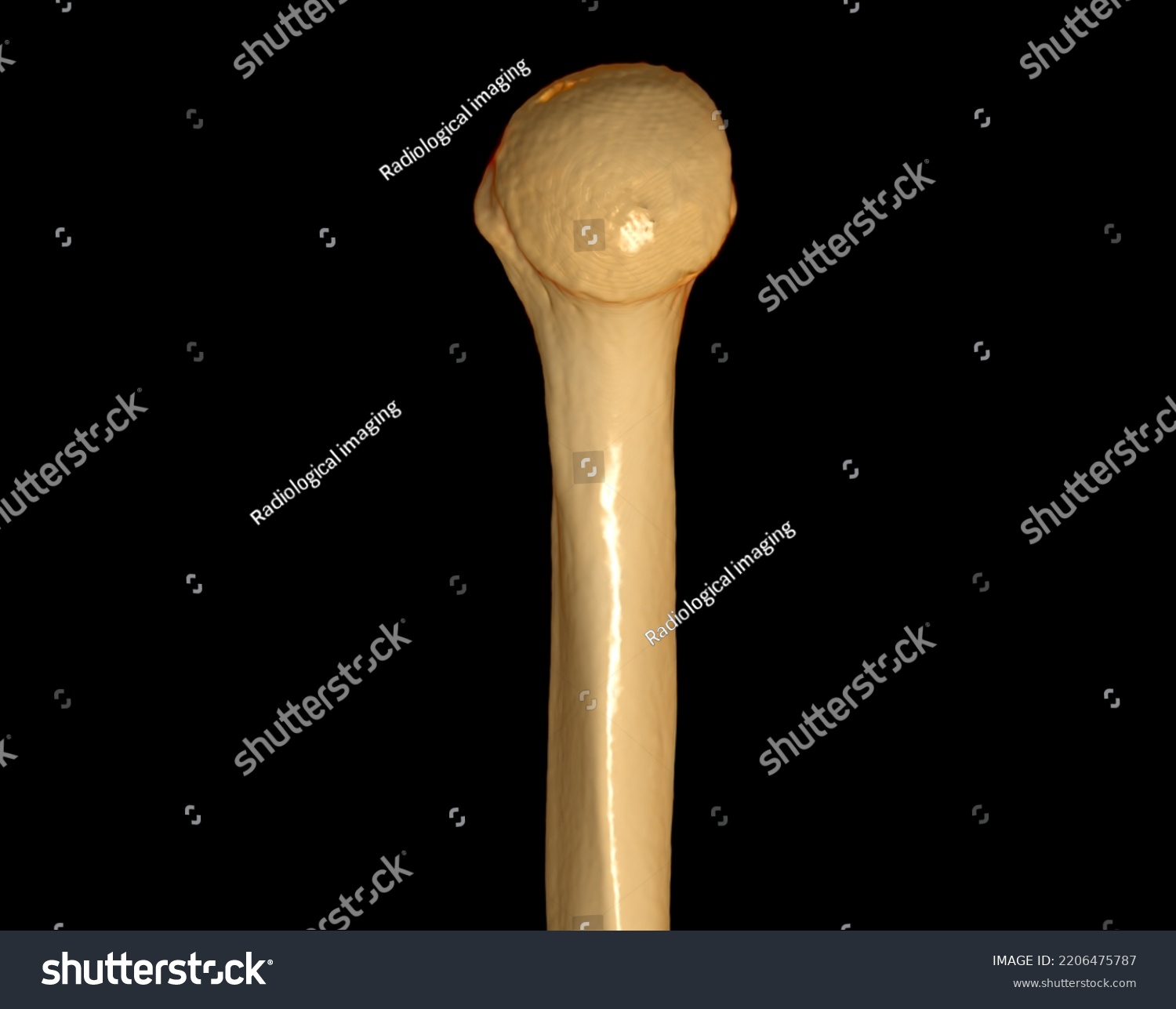 Ct Scan Head Humerus 3d Computed Stock Illustration 2206475787 ... Ct Scan Head Humerus 3d Computed Stock Illustration 2206475787 ...