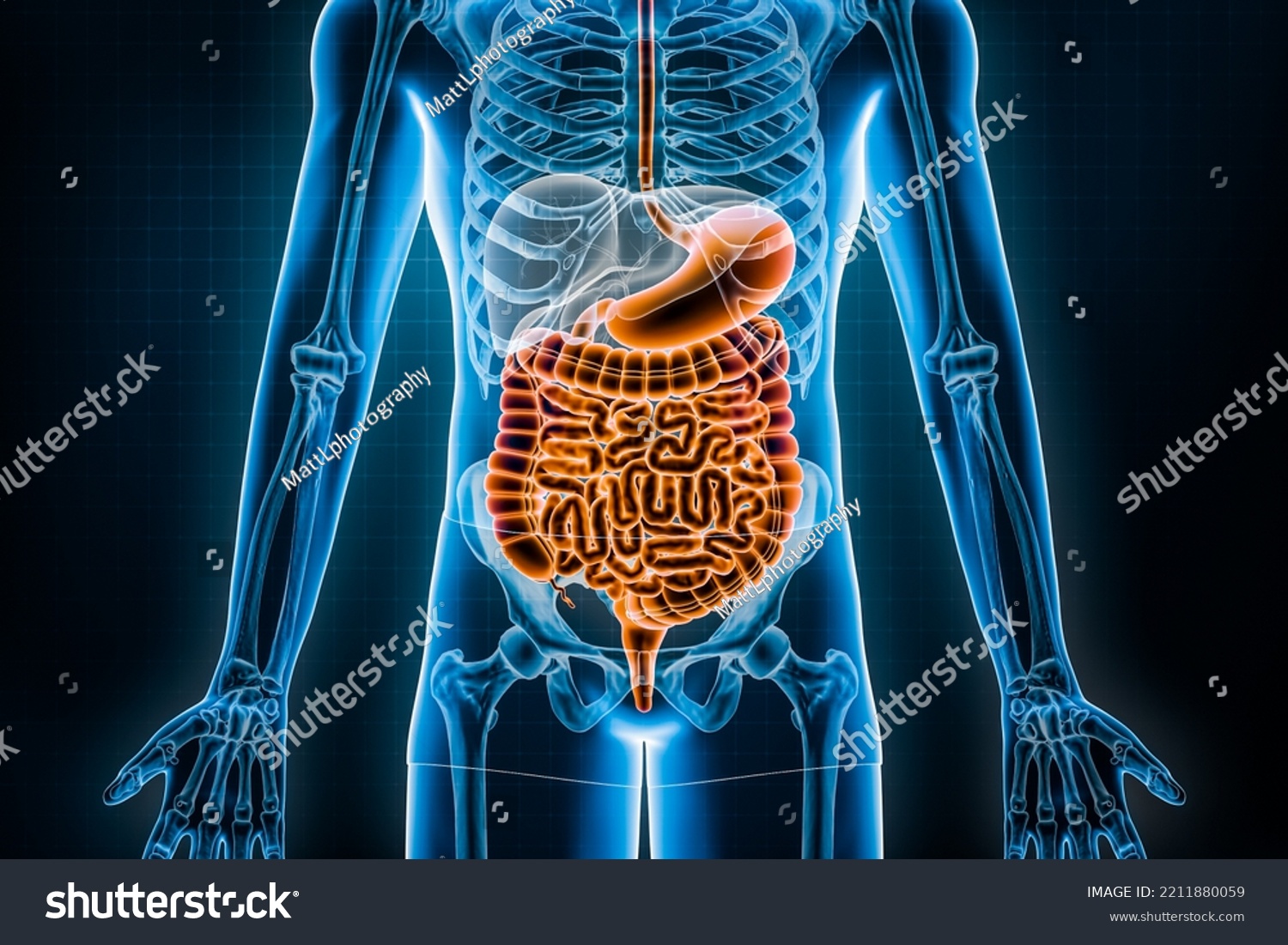 Intestinal Tract 3d Rendering Illustration Anterior Stock Illustration ... Intestinal Tract 3d Rendering Illustration Anterior Stock Illustration ...