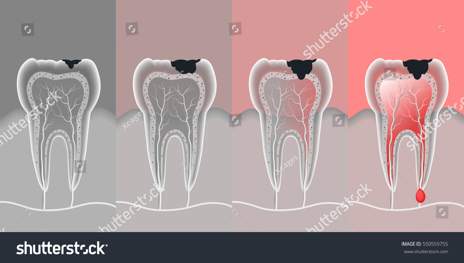 Process Teeth Problem Vector Stock Vector (Royalty Free) 550559755 ...