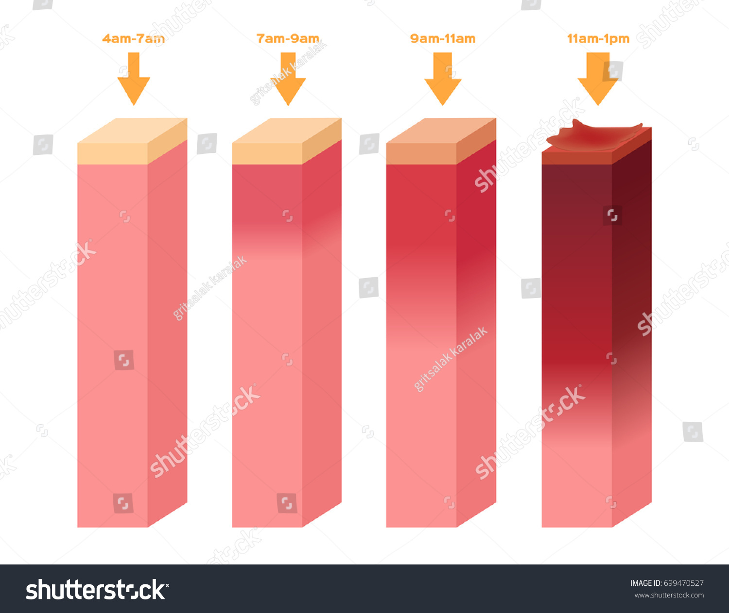 Uv Index Infographic Ultraviolet Burn Human เวกเตอร์สต็อก ปลอดค่า