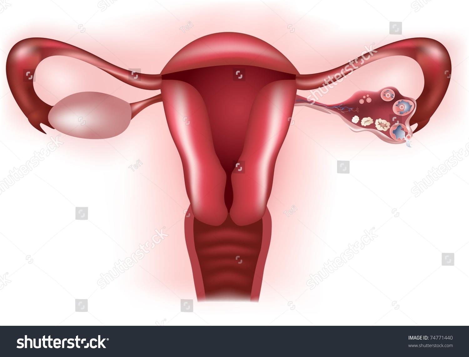 Vector Healthy Female Reproductive System Uterus 库存矢量图(免版税)74771440