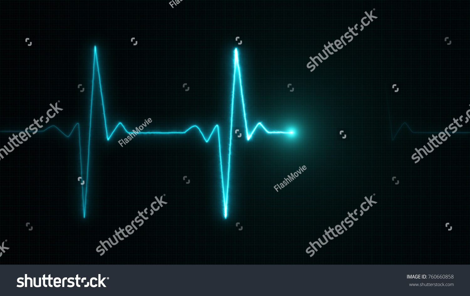 Cardiogram Cardiograph Oscilloscope Screen Blue Illustration Stock ... Cardiogram Cardiograph Oscilloscope Screen Blue Illustration Stock ...