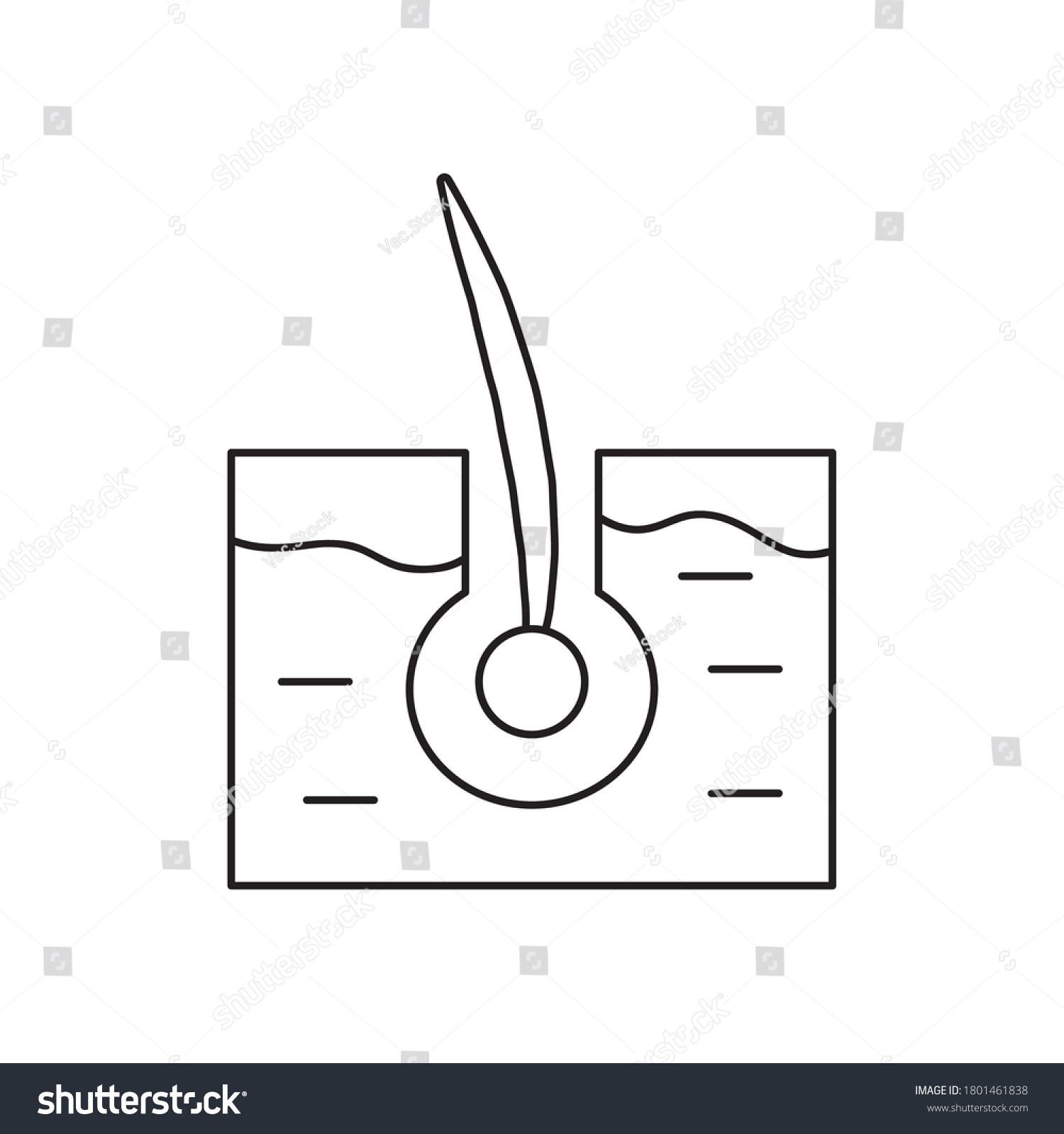 Human Body Concept Anatomy Of A Hair Follicle Royalty Free Stock