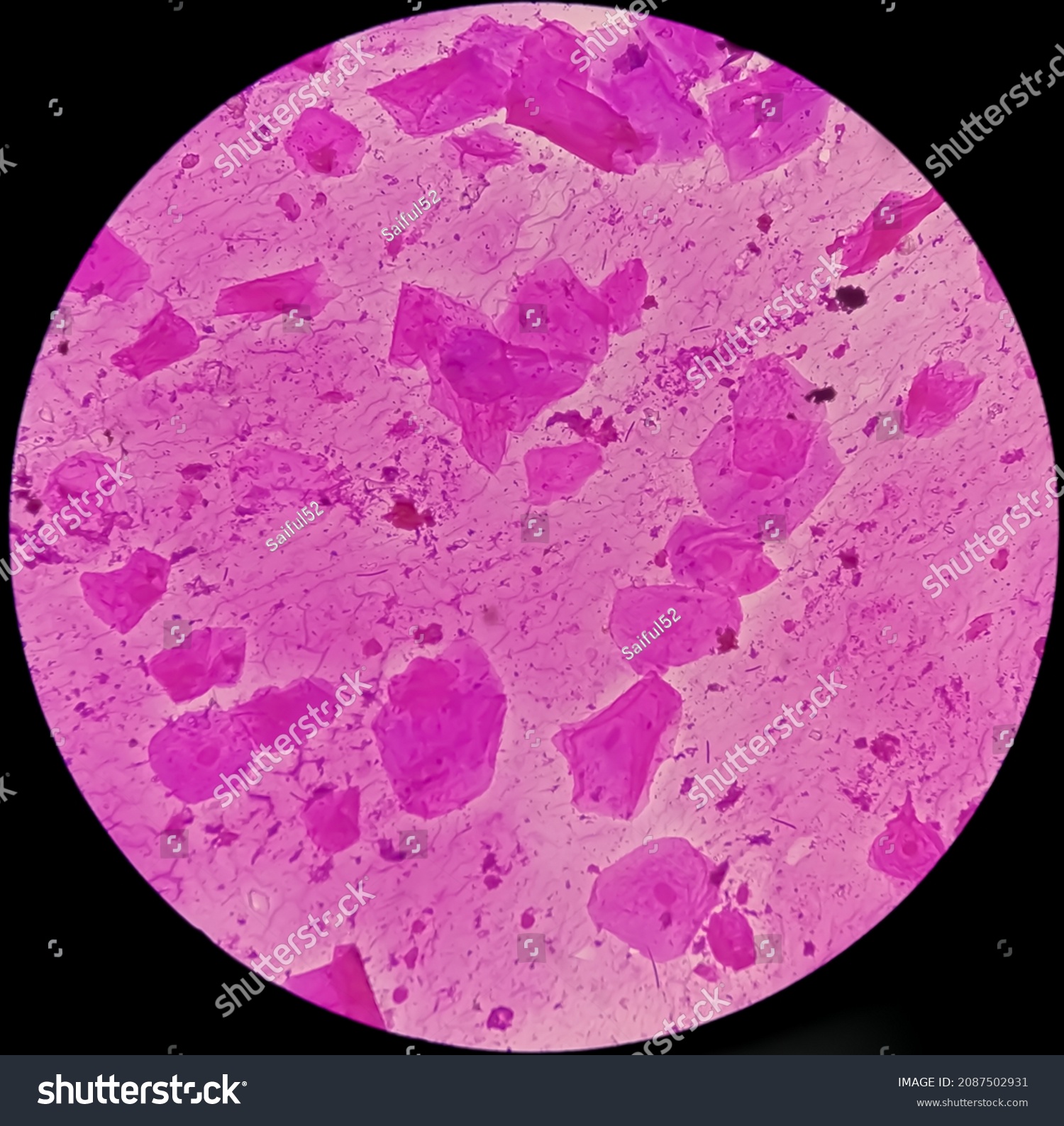 High Vaginal Swab Hvs Gram Stain Microscopic Royalty Free Stock