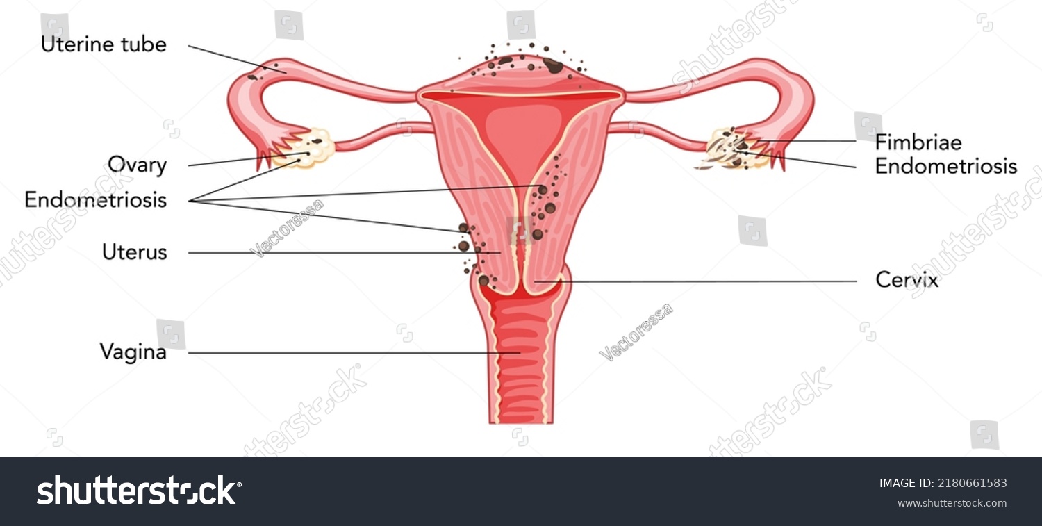 Female Reproductive System Uterus Diagram With Royalty Free Stock