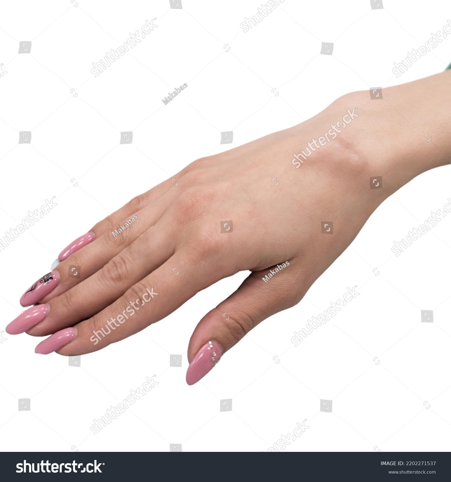 Ganglion cyst. Wrist ganglion cyst. Pain hand. - Royalty Free Stock ...