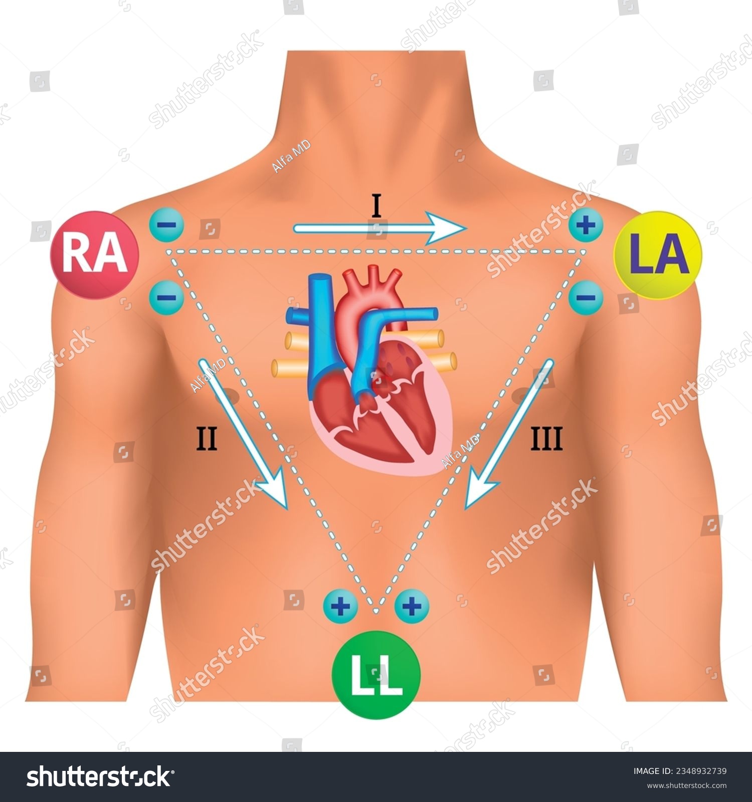 Standard Limb Leads ECG - Einthoven Triangle - - Royalty Free Stock ... Standard Limb Leads ECG - Einthoven Triangle - - Royalty Free Stock ...